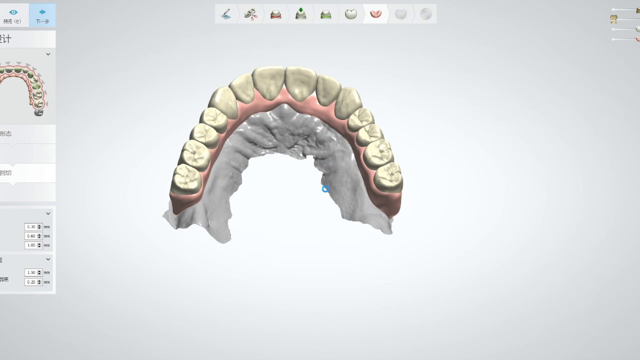 Full arch implant bridge design 3shape - YouTube