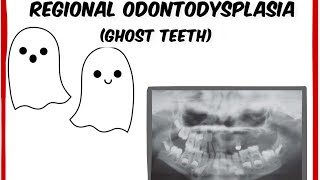 Regional Odontodysplasia