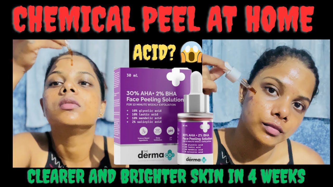 HOW TO DO A CHEMICAL PEEL AT HOME//THE DERMA CO AHA BHA PEEL FOR ...