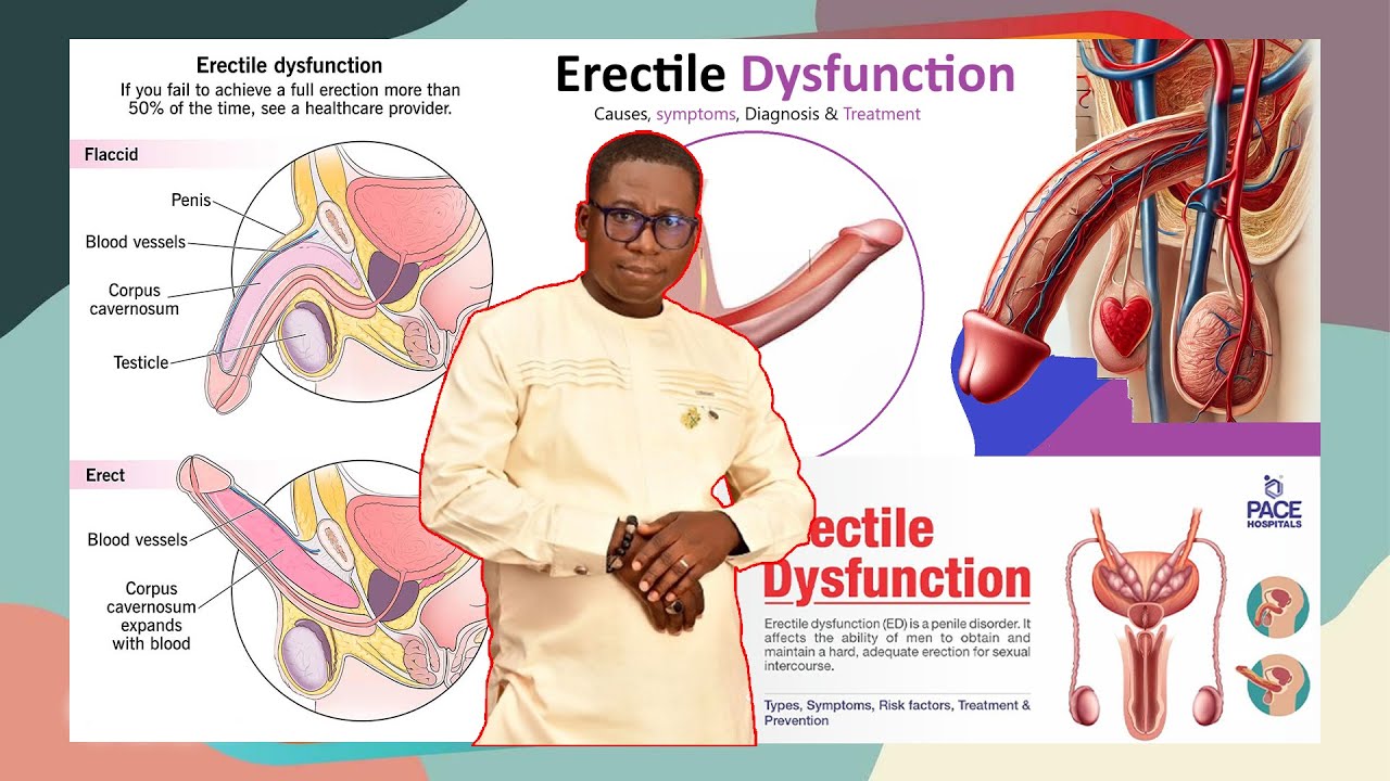 Erectile dysfunction - YouTube