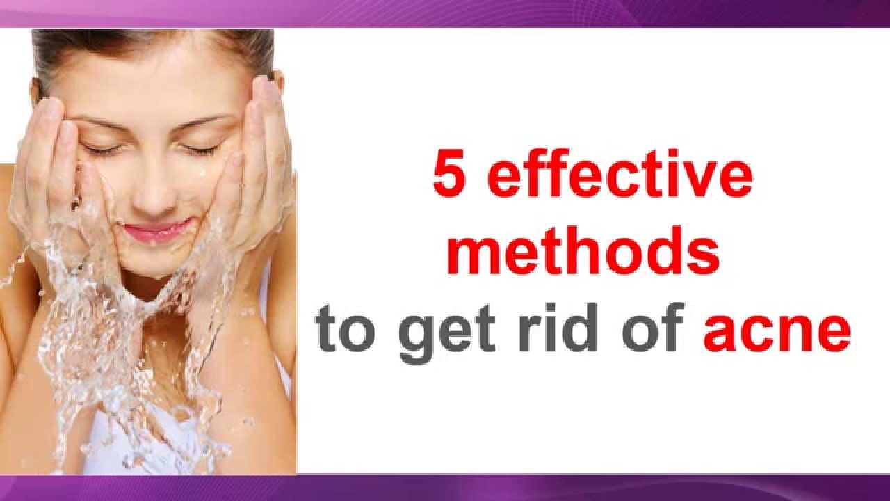 how to get rid of acne overnight | 5 methods to get rid of acne - YouTube