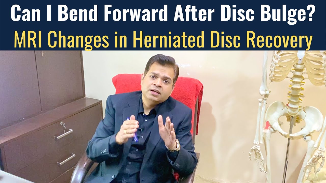 Can i Bend Forward After Disc Bulge? Herniated Disc Recovery, 3 ...