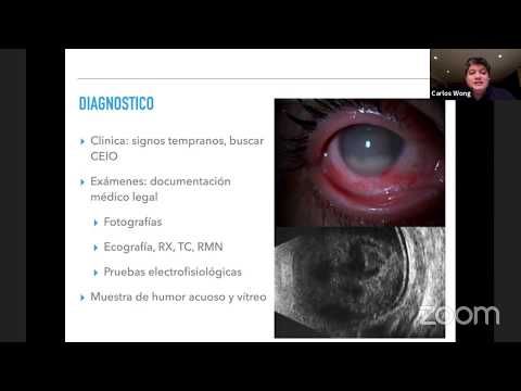 Endoftalmitis - YouTube