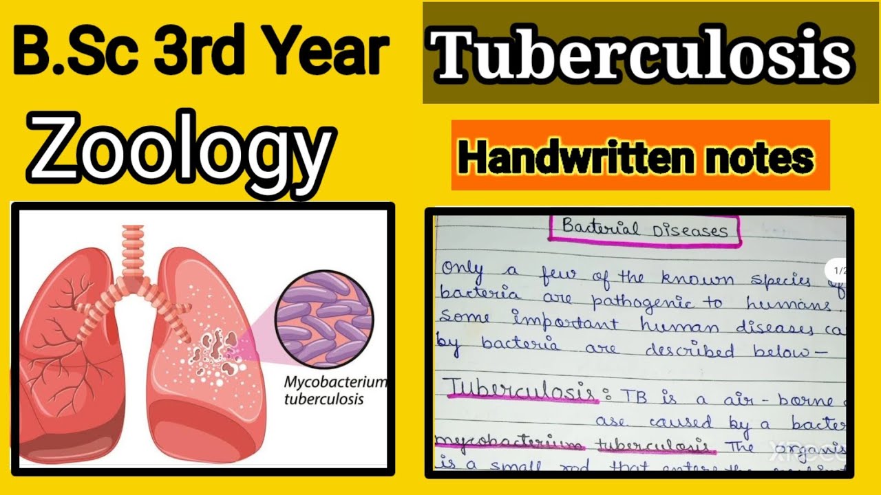 Tuberculosis क्षय रोग | Symptoms | Causes| Treatment | Handwritten ...