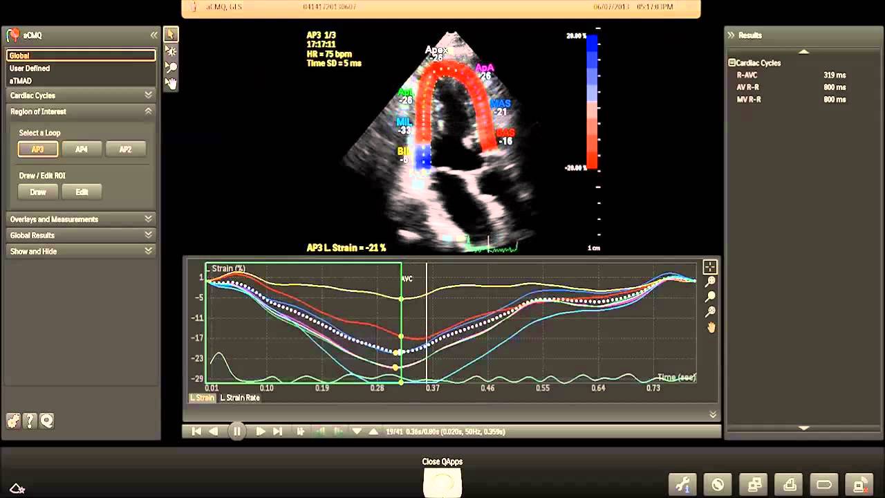 Philips qlab acmq quick guide - woogast