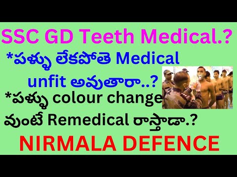 Teeth/Dental test in SSC GD/Army medical Examination||SSC GD Medical ...