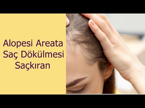 ALOPECIA Areata Saç Dökülmesi ( Saçkıran ) - (Binaural / Isochronic / Enerji Frekansı)