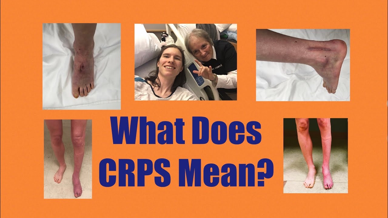 What CRPS Means to Me - YouTube