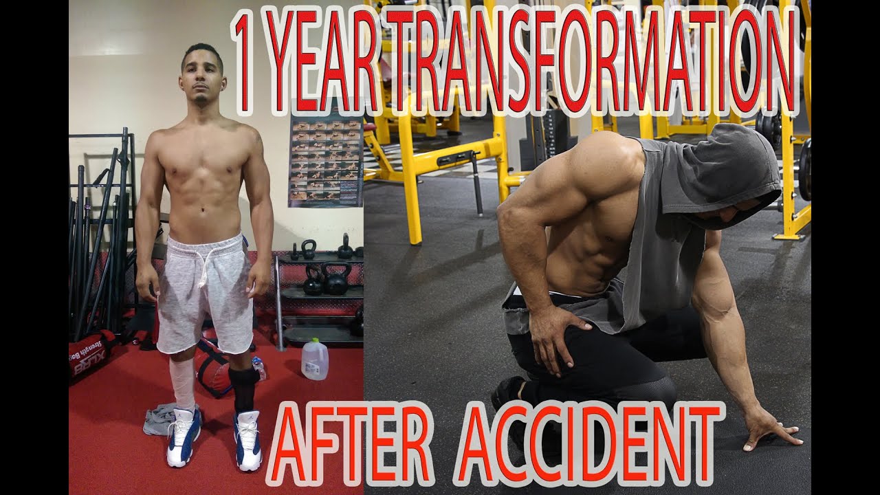 1 Year Transformation After Accident - YouTube