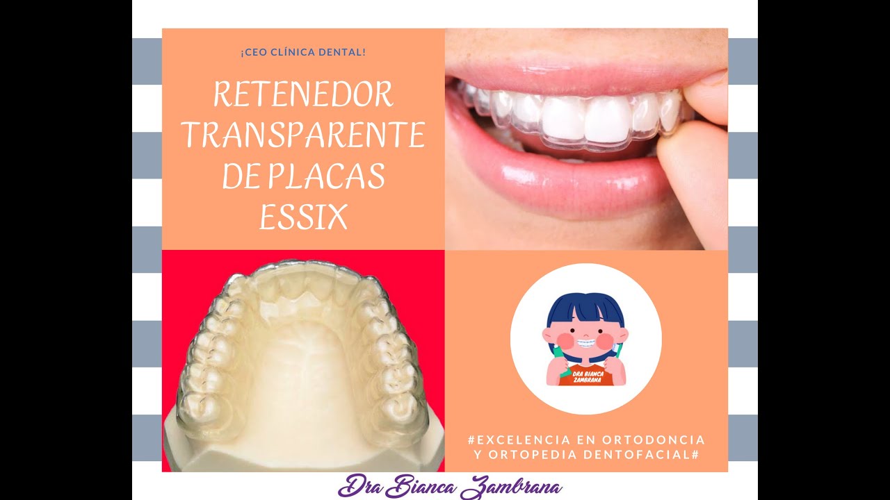 El Retenedor Transparente de Placas Essix. - YouTube