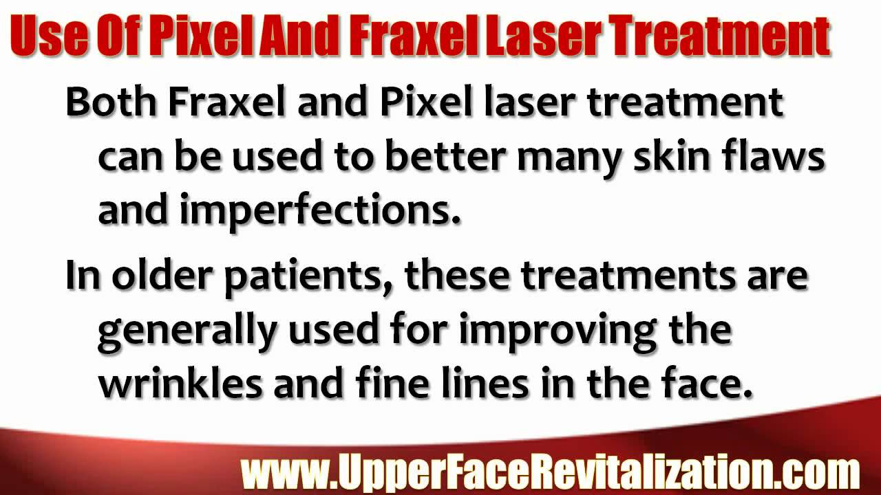 Fraxel Laser Treatment - Uses, Benefits And Warnings - YouTube