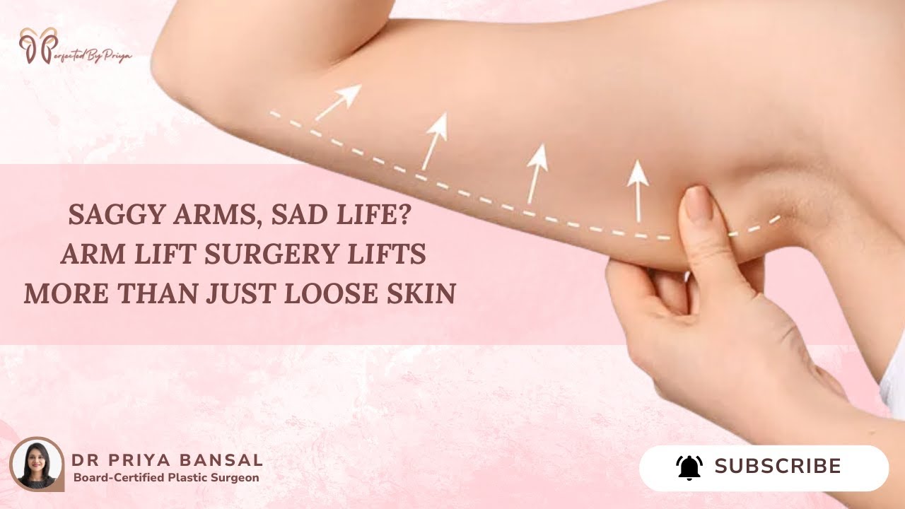 Saggy Arms, Sad Life? Arm Lift Surgery Lifts More Than Just Loose Skin ...