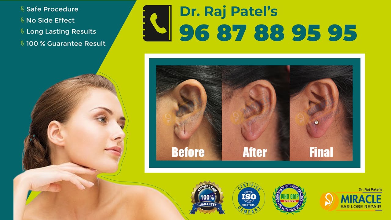Ear Lobe Repair / Ear Holl Repair / Torn Ear Repair / Ear Pasting ...