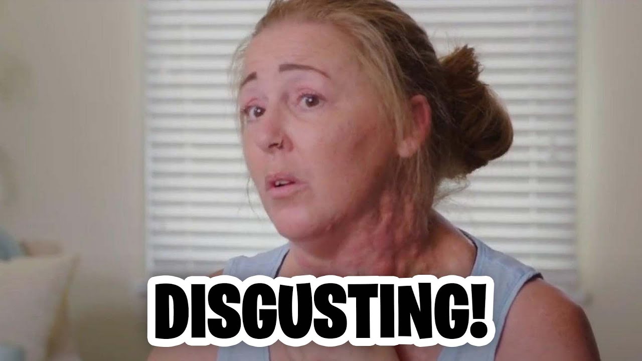 4 Of The Most DISGUSTING Dr. Pimple Popper Moments EVER! Part 26 - YouTube