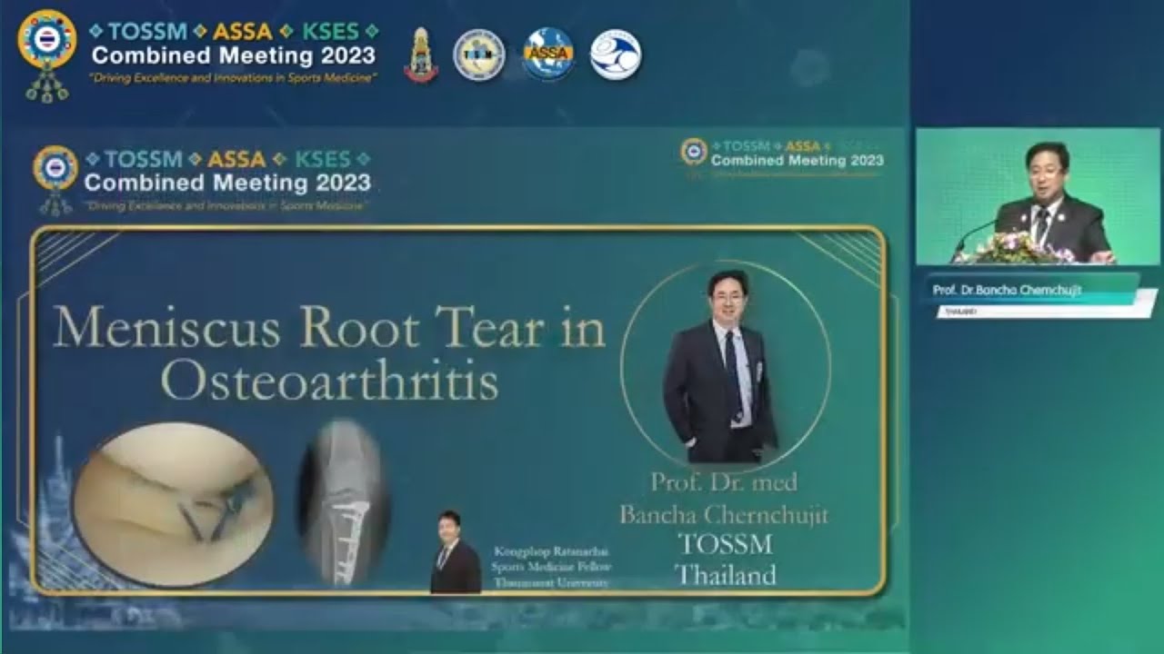 Meniscal root tear in knee osteoarthritis - YouTube