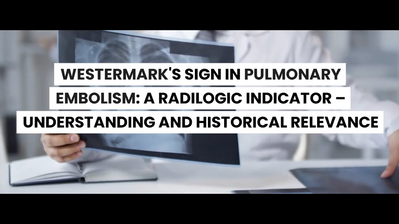 WESTERMARK'S SIGN IN PULMONARY EMBOLISM: A RADIOLOGIC INDICATOR ...