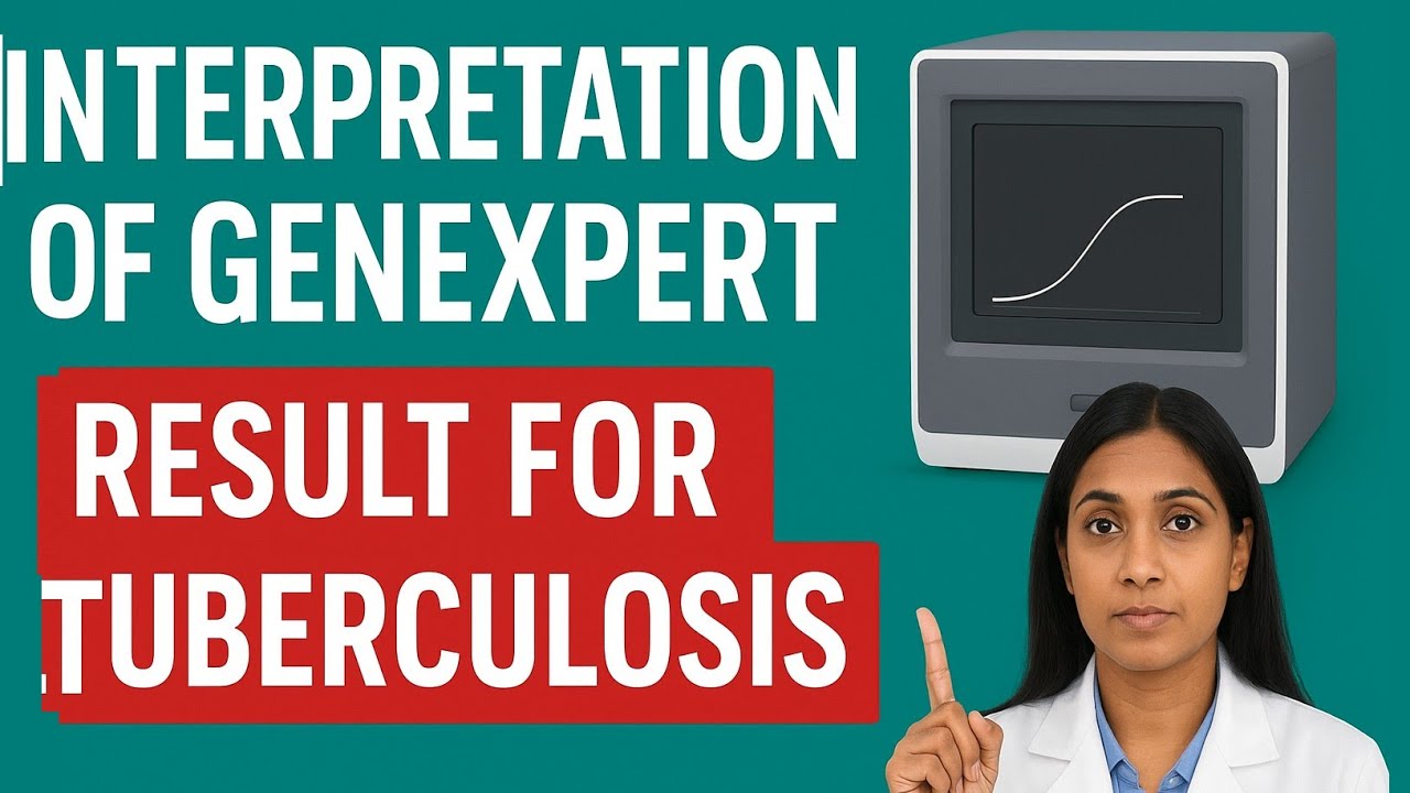 Hindi - Interpretation of Results on CBNAAT/Genexpert MTB Rif test ...