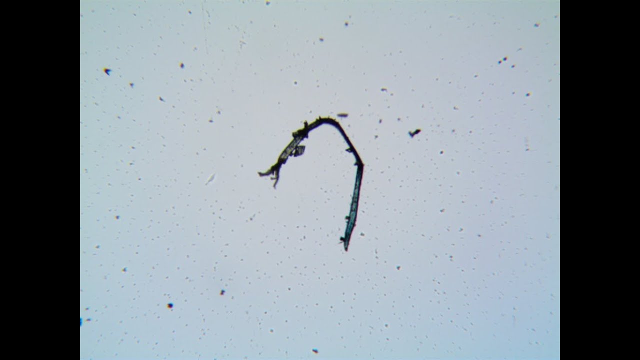 Morgellons Now Exposed - YouTube