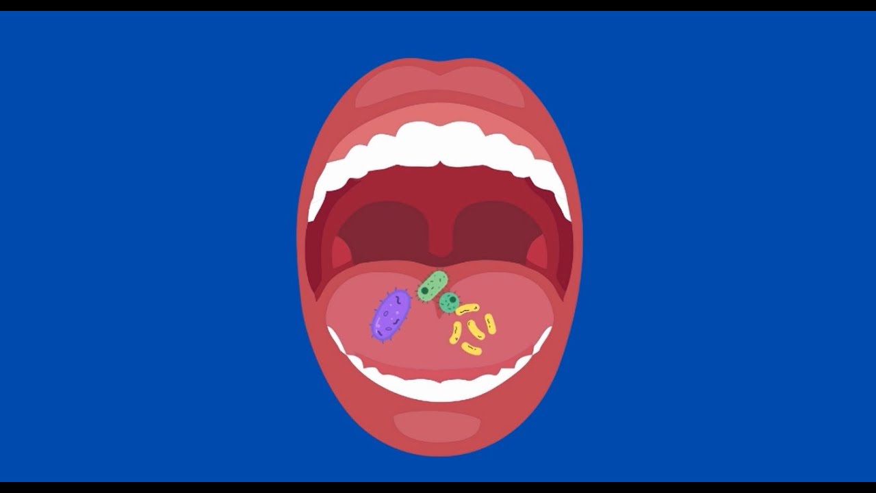 Halitosis or Bad Breath: Causes, Effects, and Solutions - YouTube