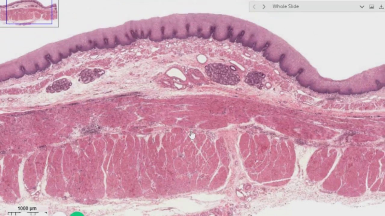 Esófago - Histología - YouTube