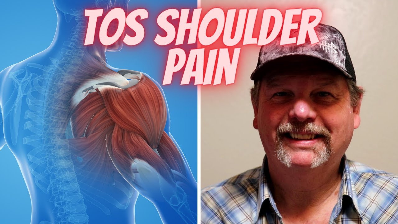 Left Shoulder Pain ~ Thoracic Outlet Syndrome ~ TOS Shoulder Pain - YouTube