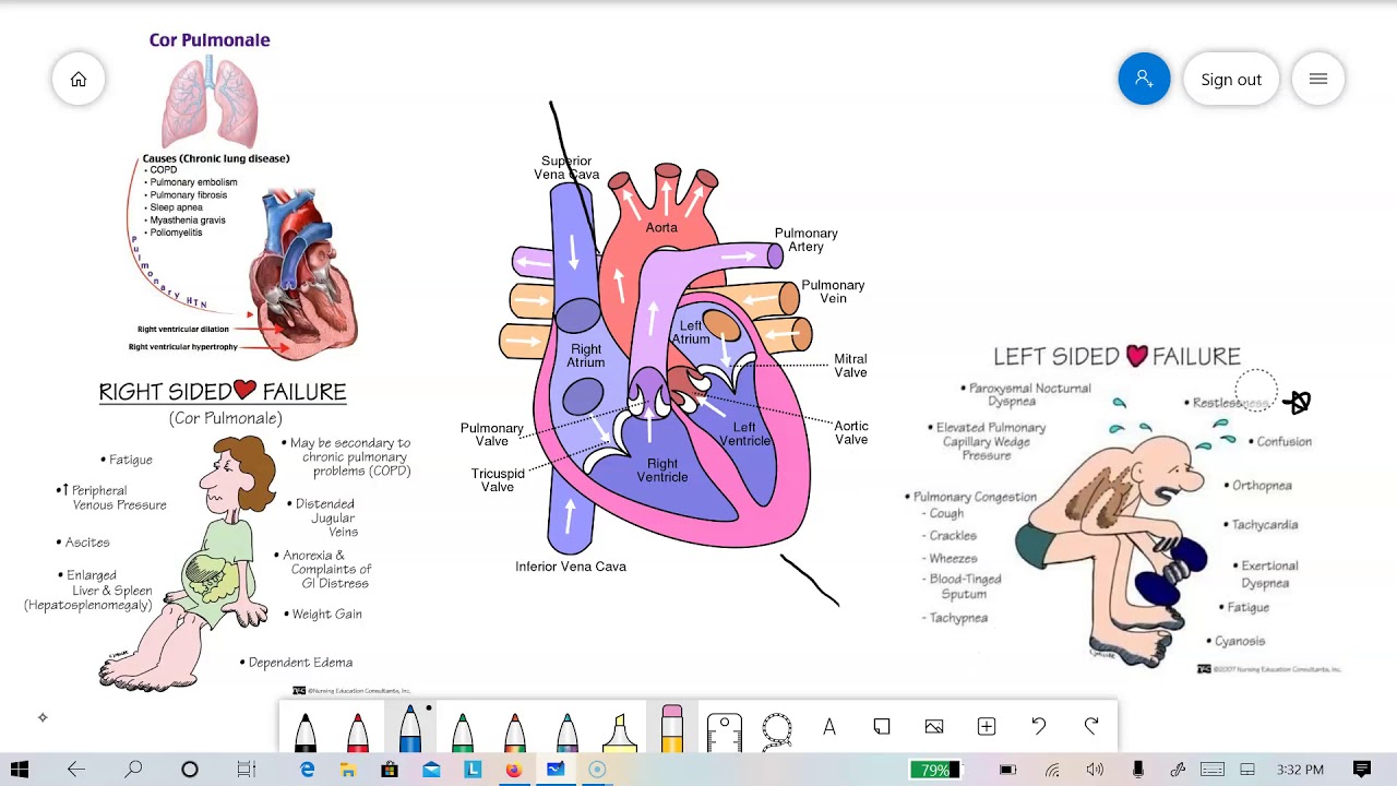 Quick Overview of Heart Failure - YouTube