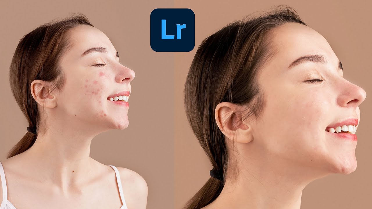 Face retouching in lightroom mobile | pimples remove in 2 minutes - YouTube