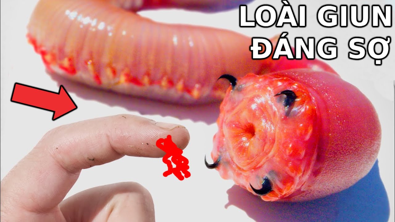ĐỪNG ĐỂ LOÀI GIUN NÀY CẮN BẠN | GNDTT - YouTube