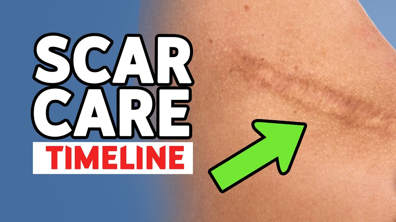 Scar Care After Surgery | Tips for Faster Healing & Fading - YouTube