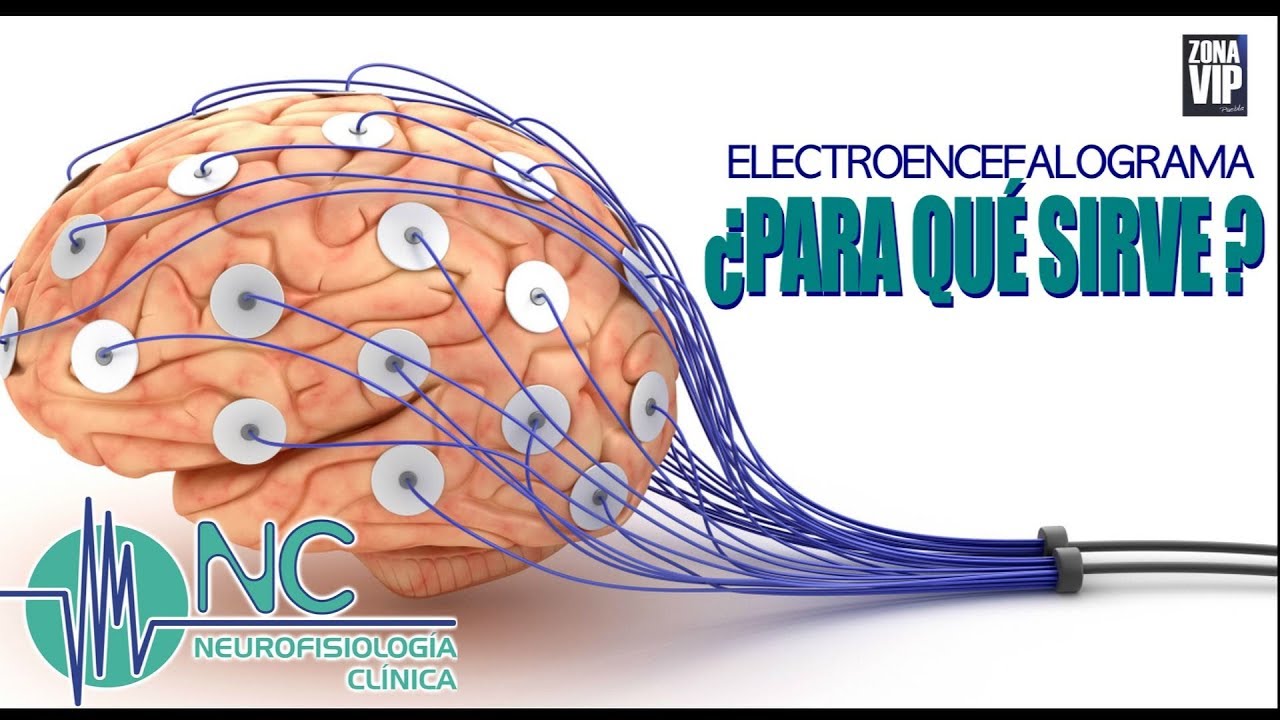 "ELECTROENCEFALOGRAMA" - YouTube
