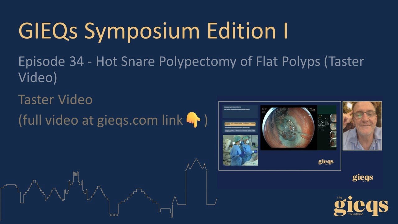 Episode 34 - Hot Snare Polypectomy of Flat Polyps (Taster Video) - YouTube