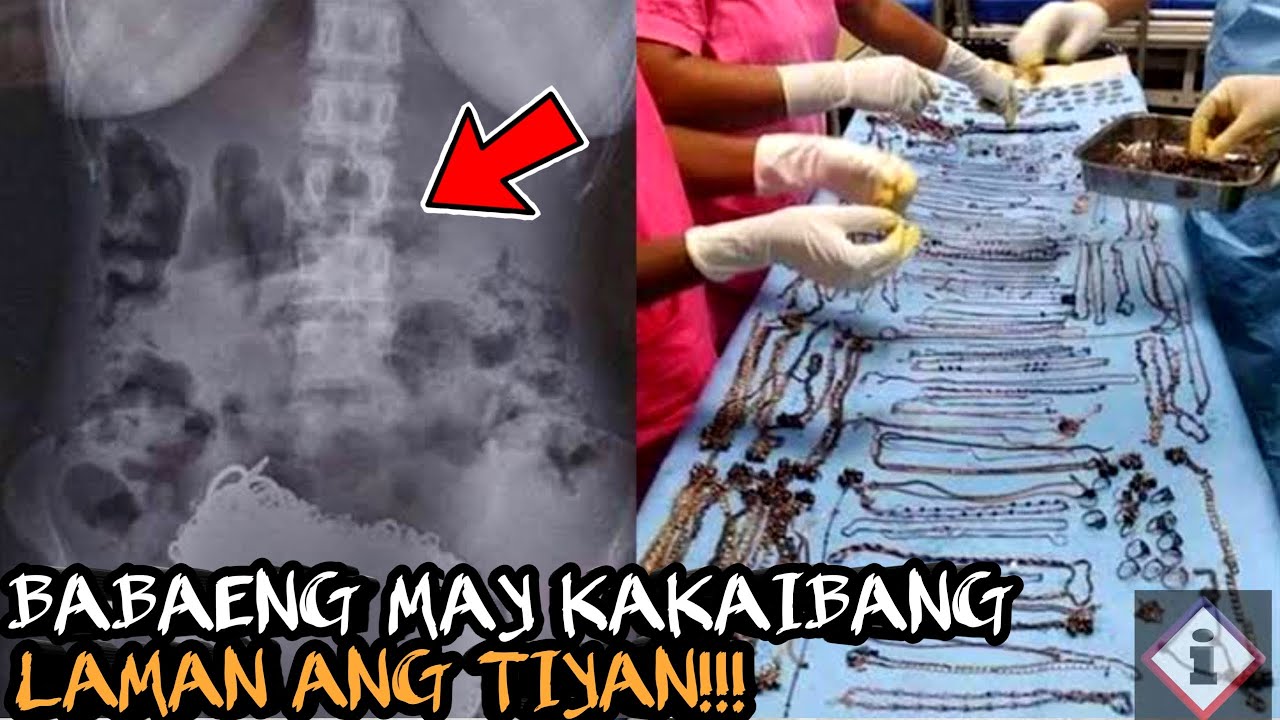 Babaeng sumasakit ang tiyan, nakitaan ng alahas at pera na may halagang ...