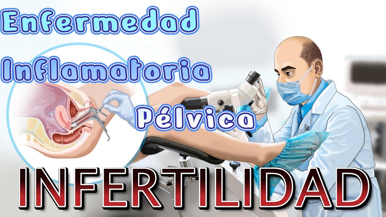 EXAMEN USMLE STEP 2: Enfermeda Inflamatoria Pélvica. Conceptos a ...