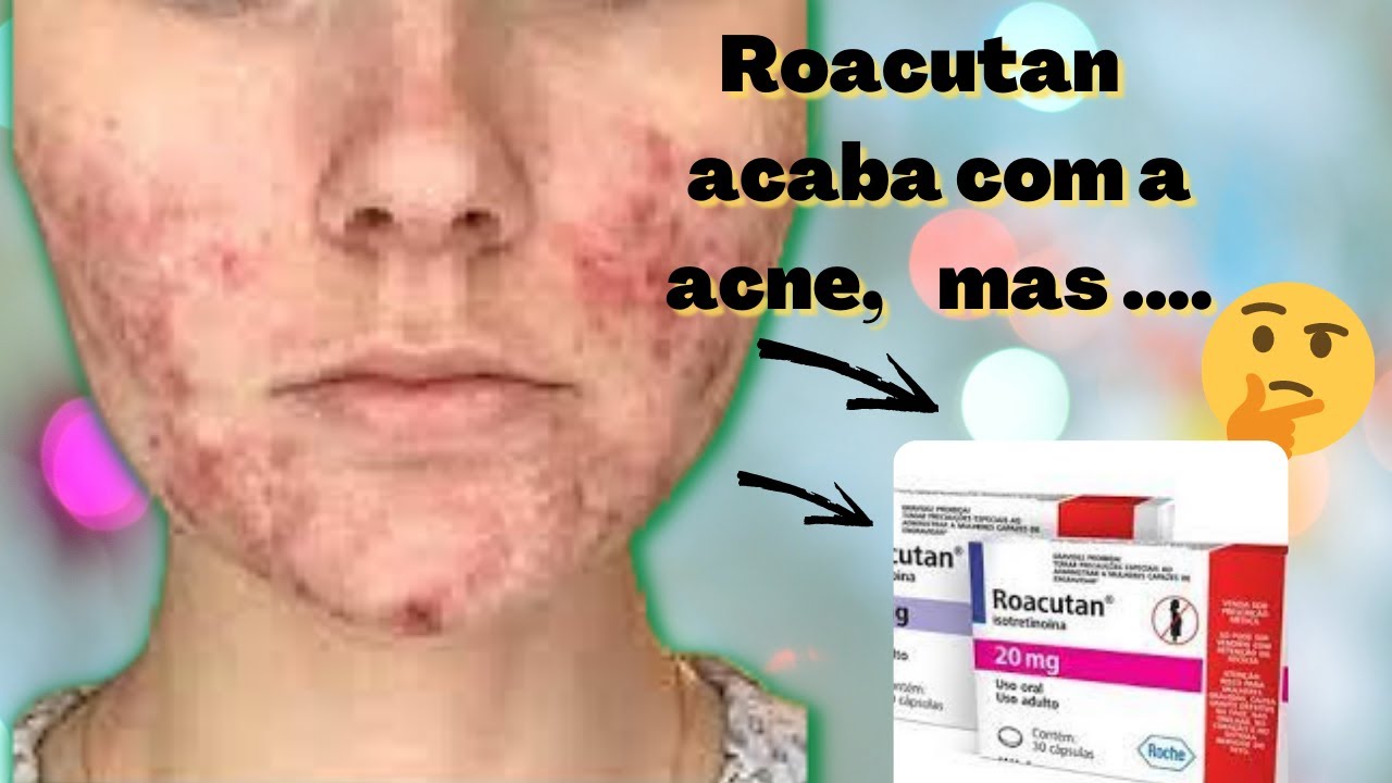 Roakutan (video 2) - YouTube