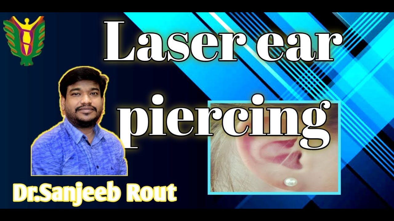 Laser Ear Piercing || Dr. Sanjeeb Rout || Balaji Skin and Hair Clinic ...