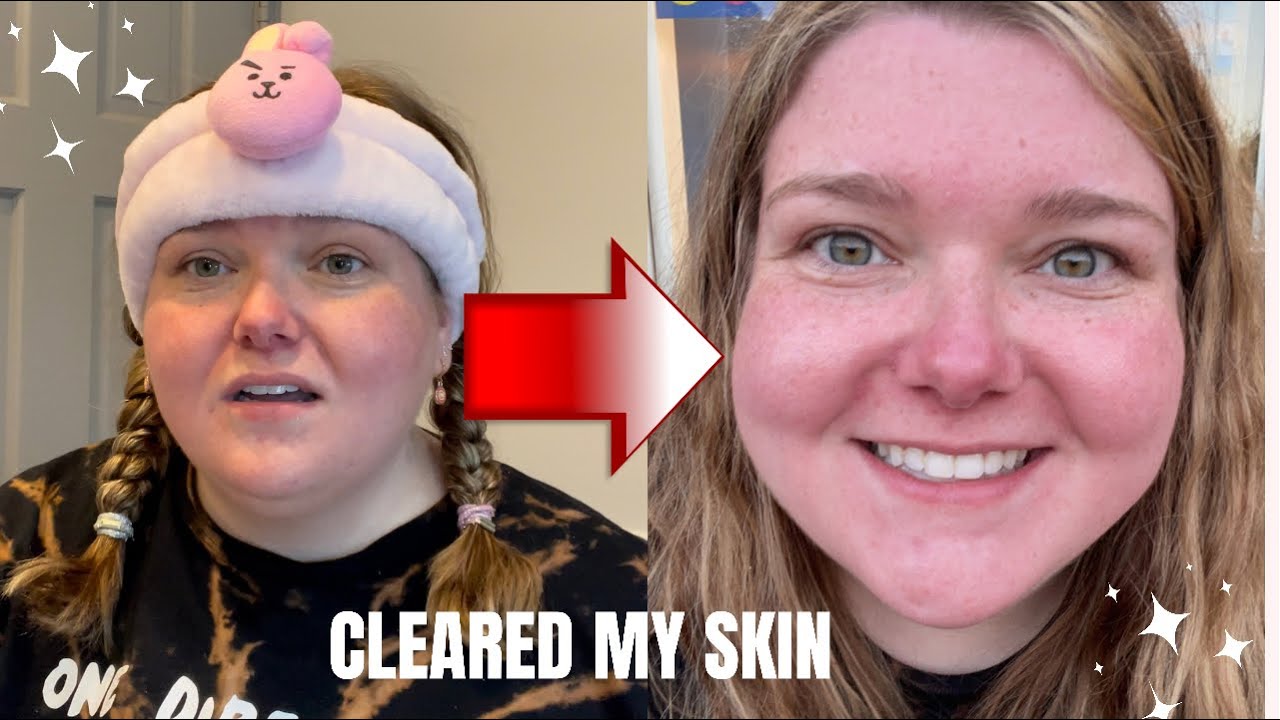 I FOLLOWED STRAY KIDS FELIX SKINCARE ROUTINE | Kpop Idol Skincare - YouTube