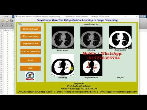Lung Cancer Detection Using Machine Learning Matlab Project Source Code ...