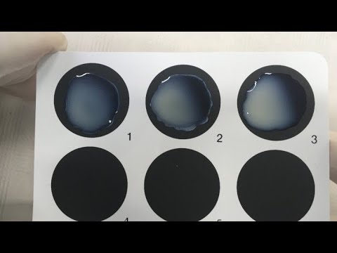 Técnica de ASO-LATEX - YouTube