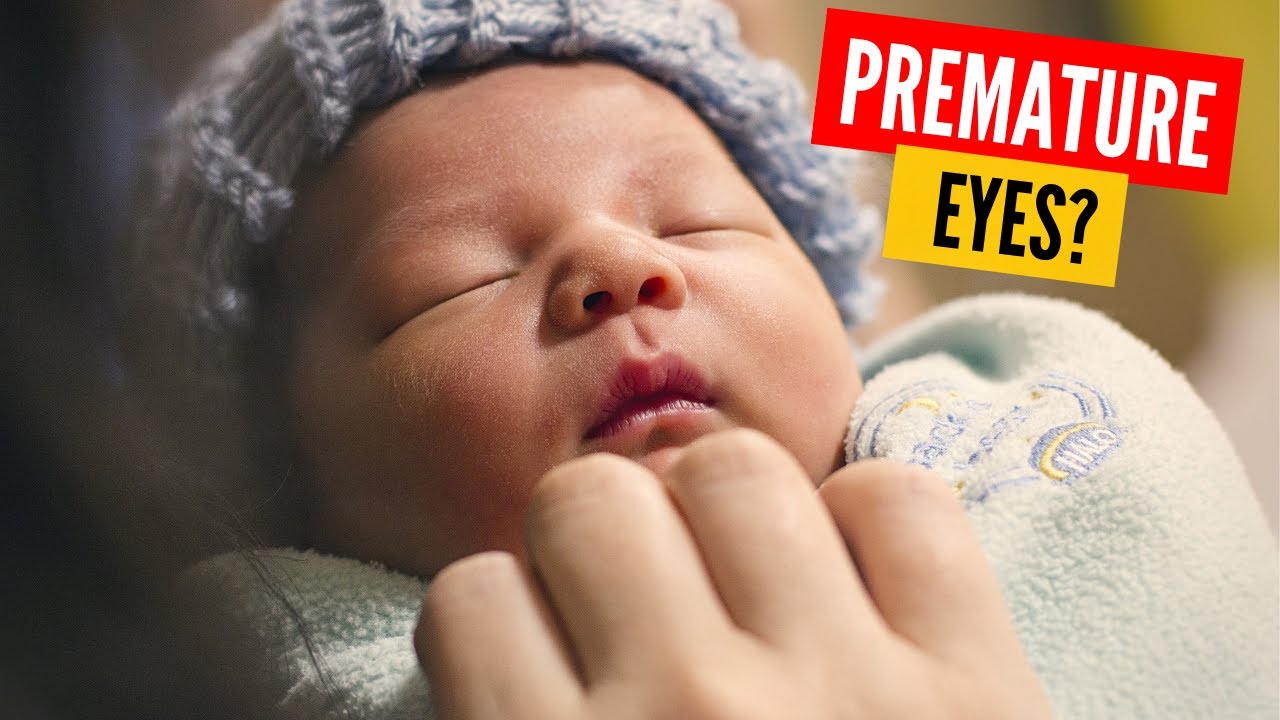 The Shocking Reality of Premature Baby Eyes - YouTube