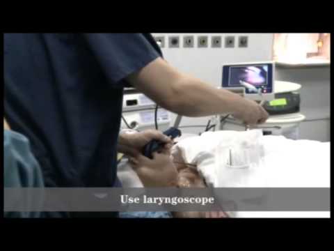 Truflex Stylet used with Glidescope - YouTube
