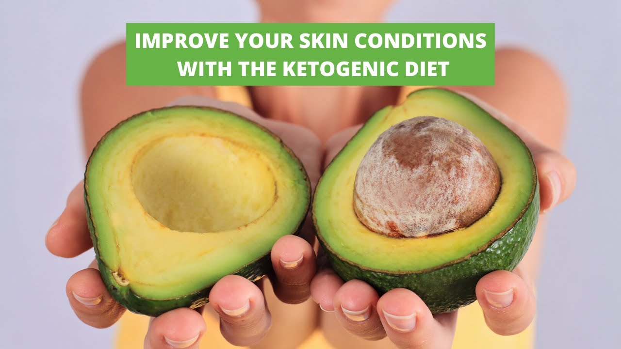 Improve Your Skin Conditions With The Keto Diet - YouTube