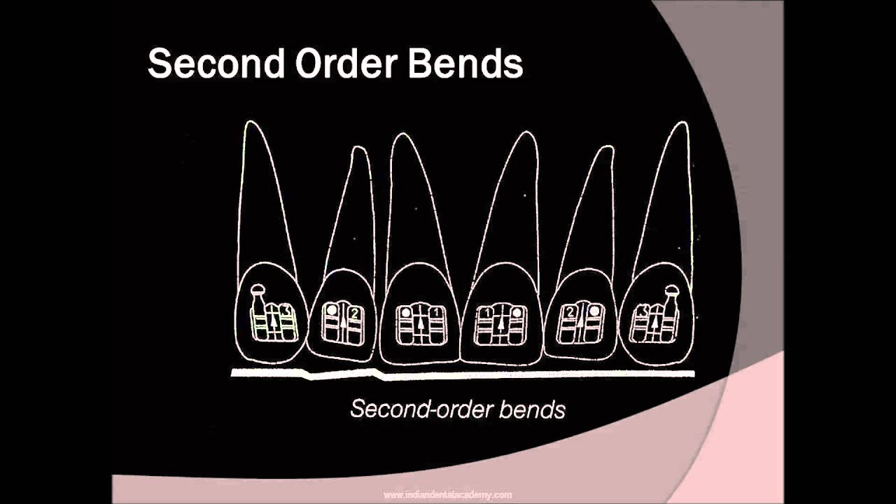 Bends In The Arch Wire Orthodontic Course For General Dentists By bends-in-the-arch-wire-orthodontic-course-for-general-dentists-by