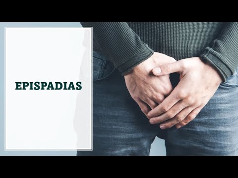 Epispadias In Men : A Rare Condition With Unique Challenges ...