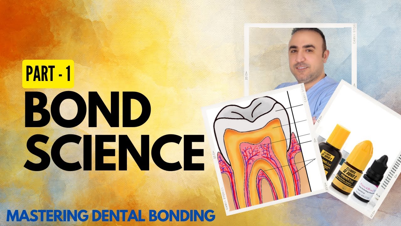 1- سلسلة إتقان Dental Bonding في طب الأسنان الجزء (1) - Unveiling the ...