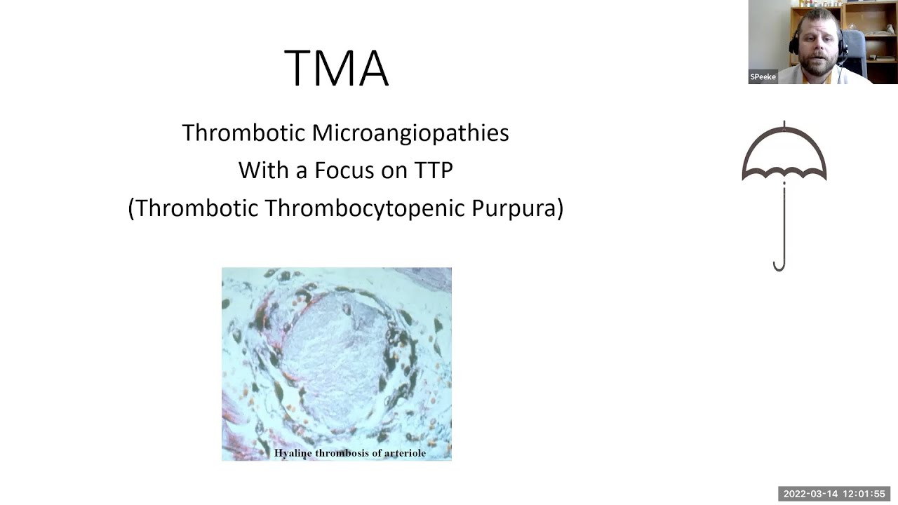 Thrombotic Microangiopathies with a Focus on TTP (Thrombotic ...