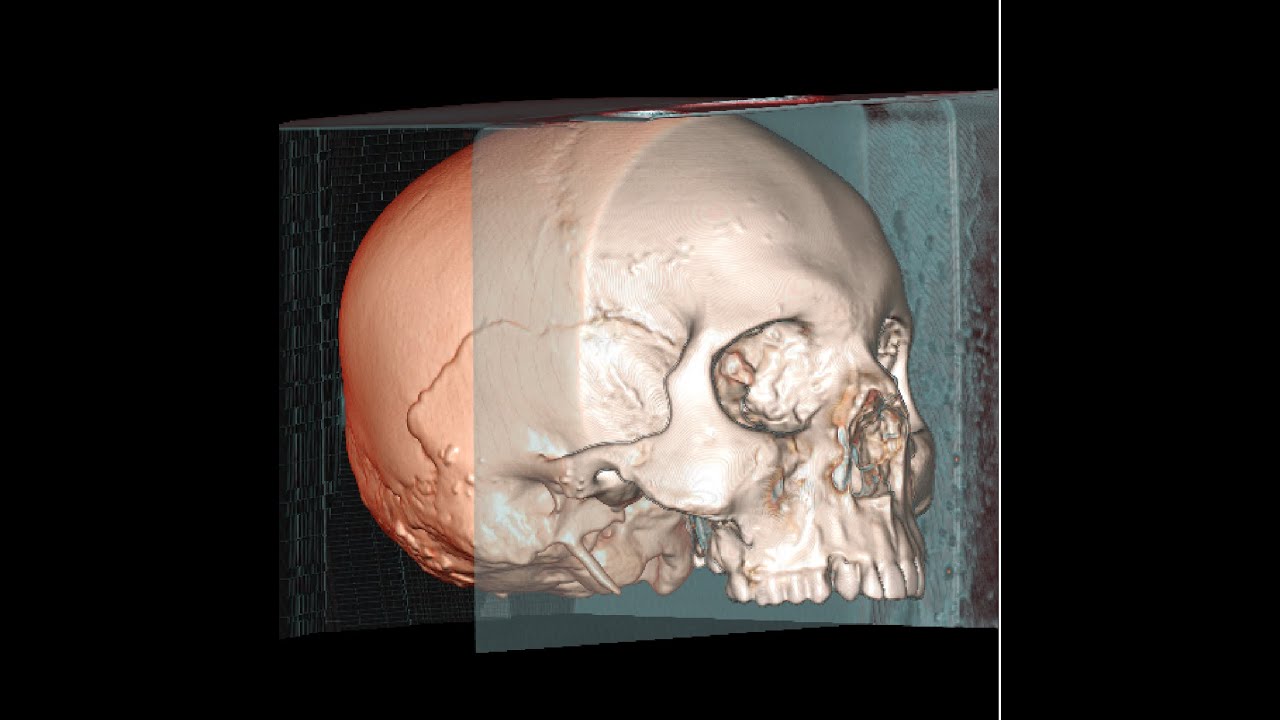 Kronan timelapse: Converting CT Scan to Mesh - YouTube