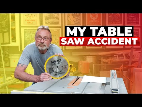 My Table Saw Accident | How I Nearly Lost My Finger! - YouTube