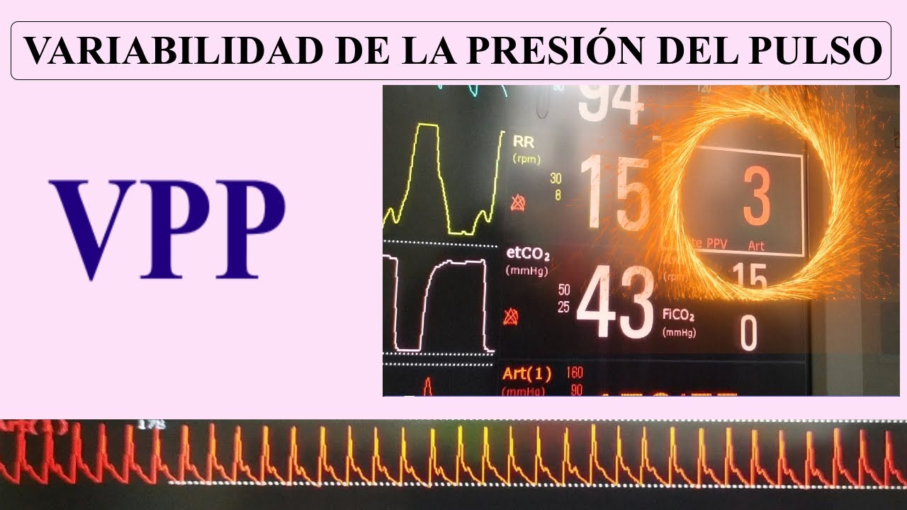 VARIABILIDAD DE LA PRESION DEL PULSO (VPP) / VARIACIÓN / CONFIGURACIÓN ...