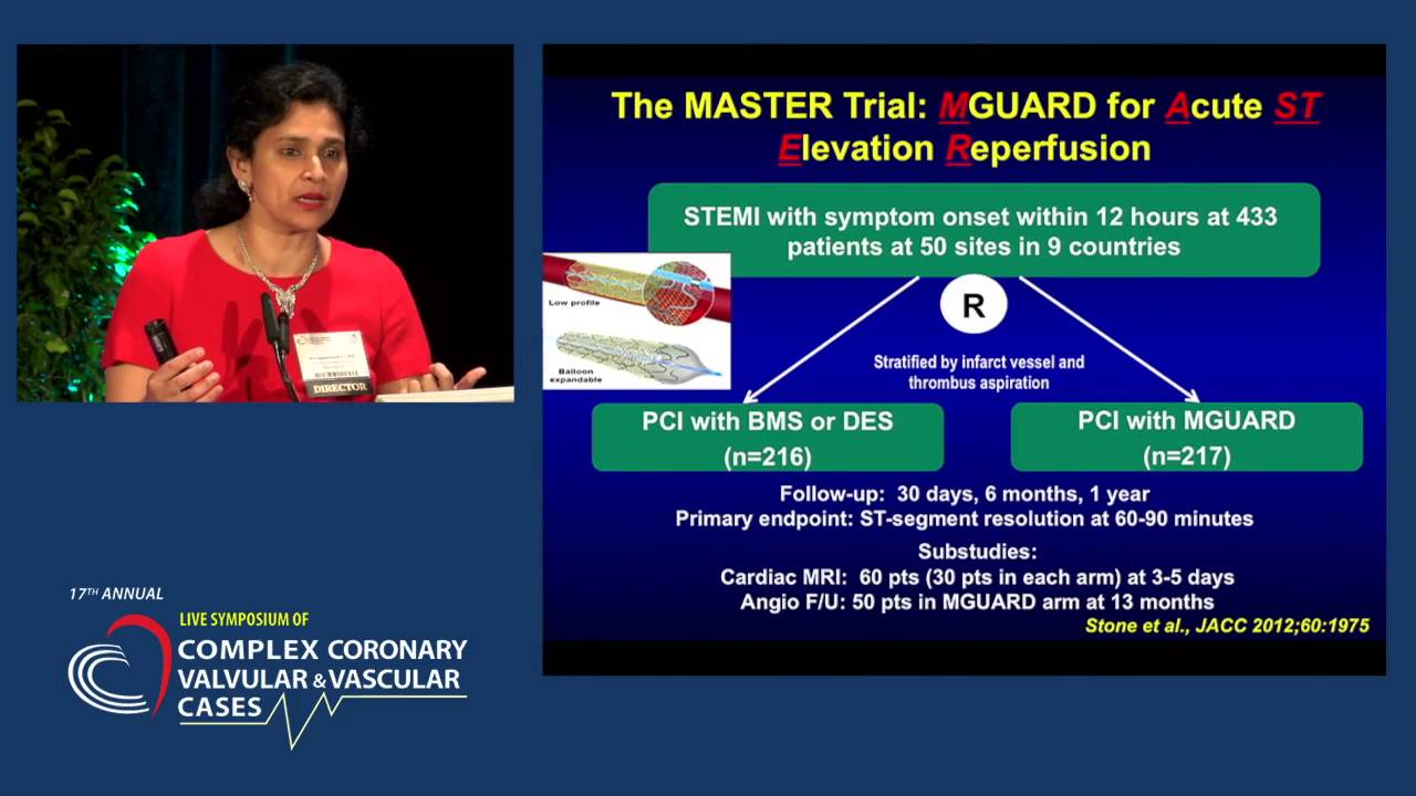 Beyond D2B Time in STEMI Care - YouTube