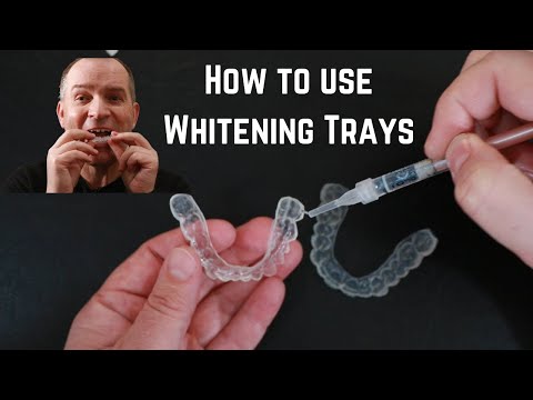 How To Use Take Home Whitening Trays From Dentist